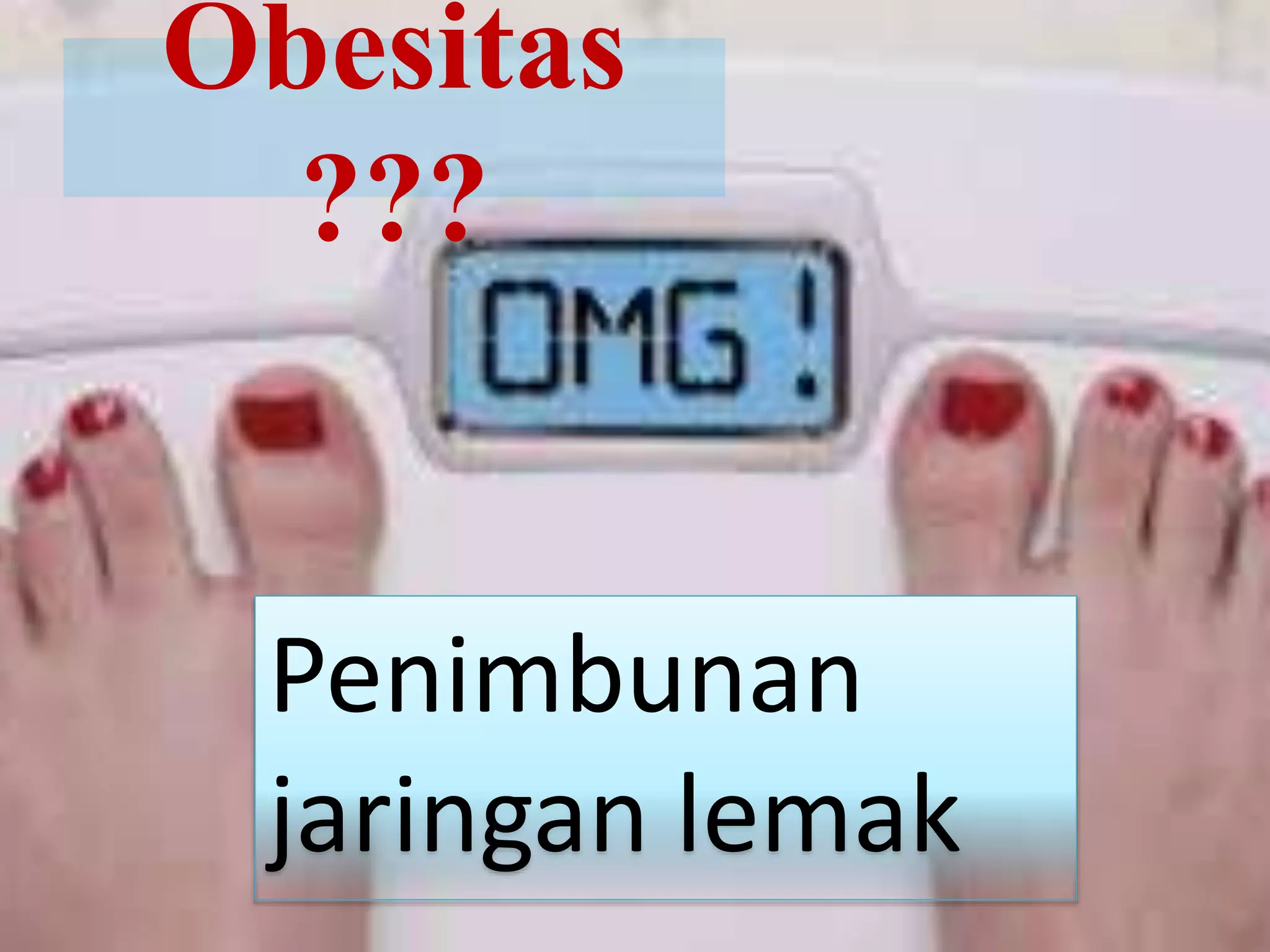 Obesitas pada anak | PPTX