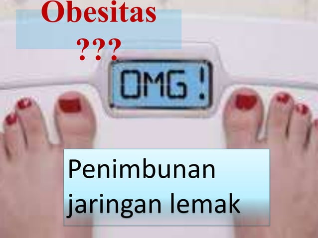 Obesitas pada anak | PPTX