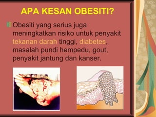 Obesiti | PPT