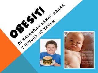 Obesiti | PPT