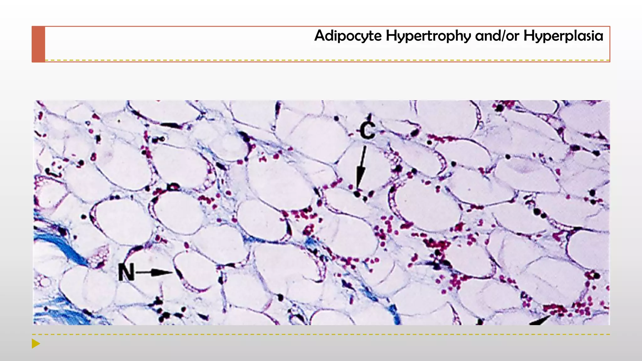 Obesity | PPTX
