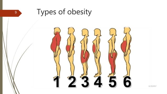 Obesity | PPTX | Endocrine and Metabolic Diseases | Diseases and Conditions