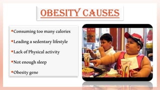 Obesity.pdf