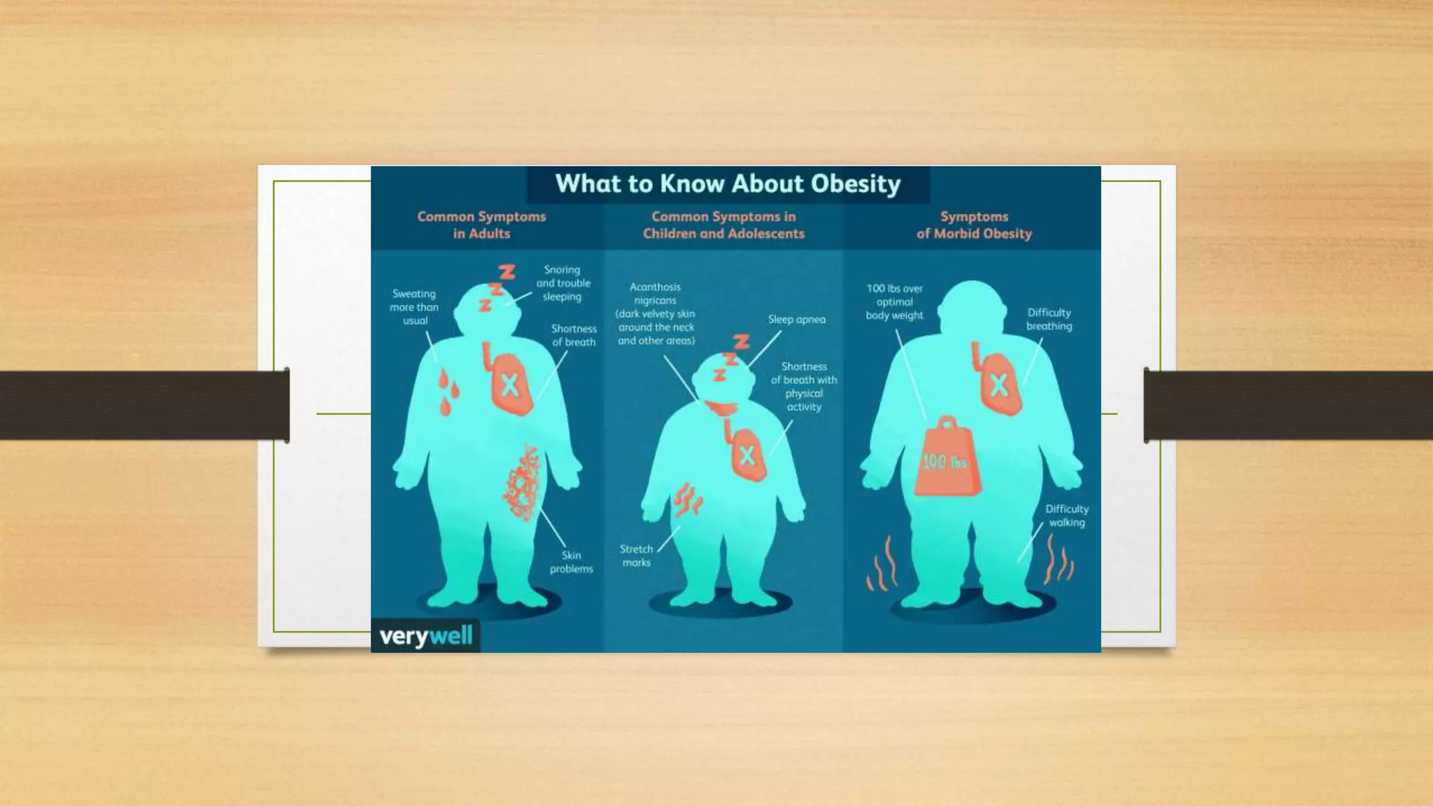 obesity.pptx