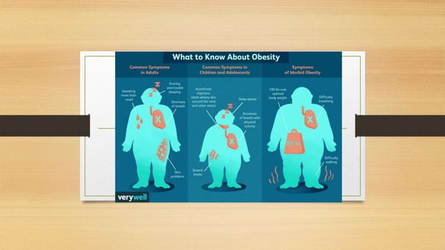 obesity.pptx