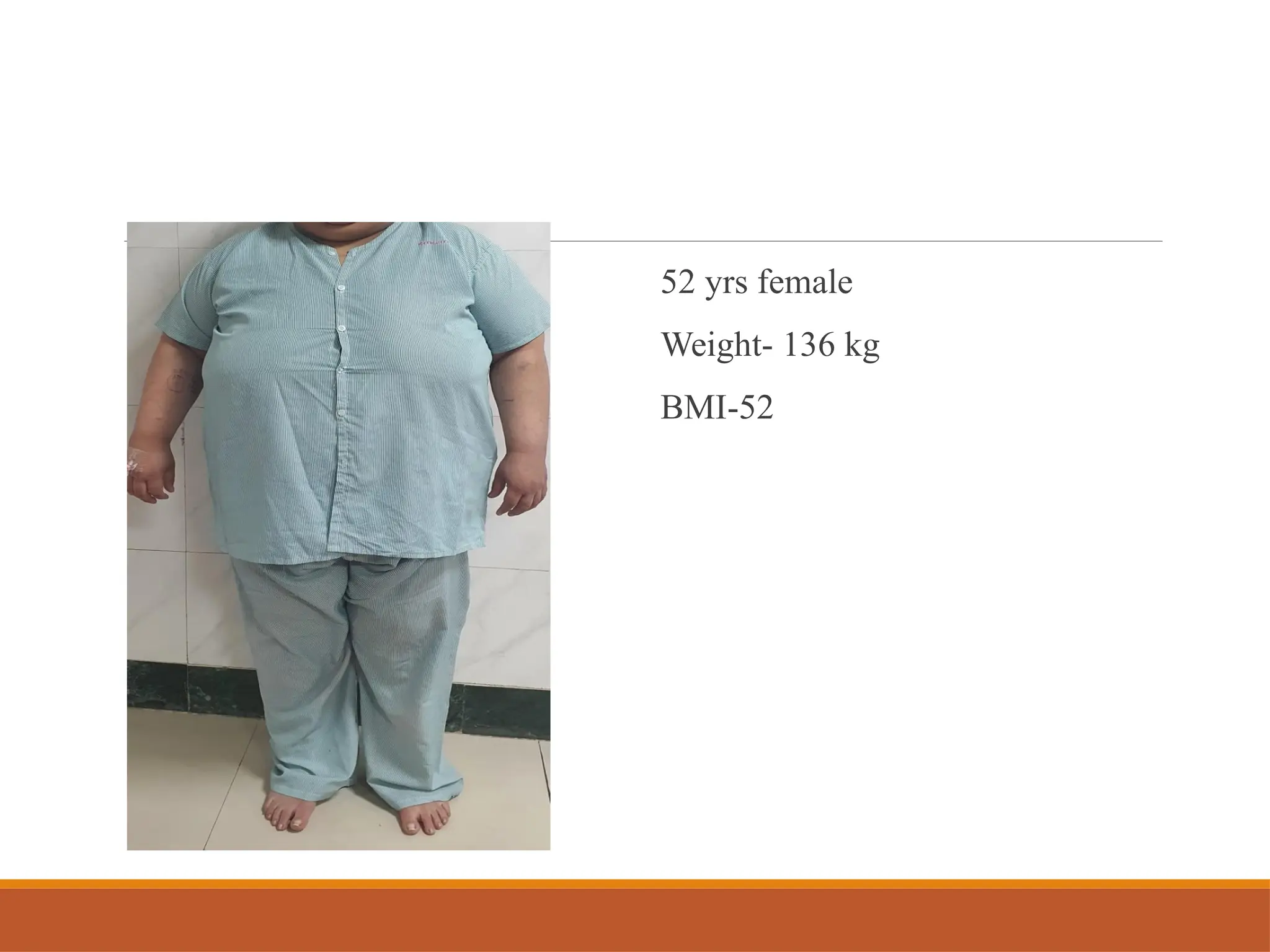 Anesthetic challenges in morbid obesity patient | PDF