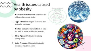 Understanding Obesity: Causes, Risks, and Solutions | PDF