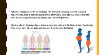 Obesity. General overview, Pathophysiology, Criteria, Management. | PPTX