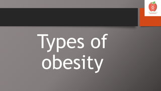 Obesity and its management in India.pptx