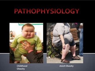 obesity 2.pptx