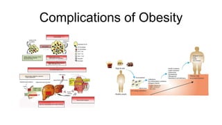 Complications of obesity | PPTX