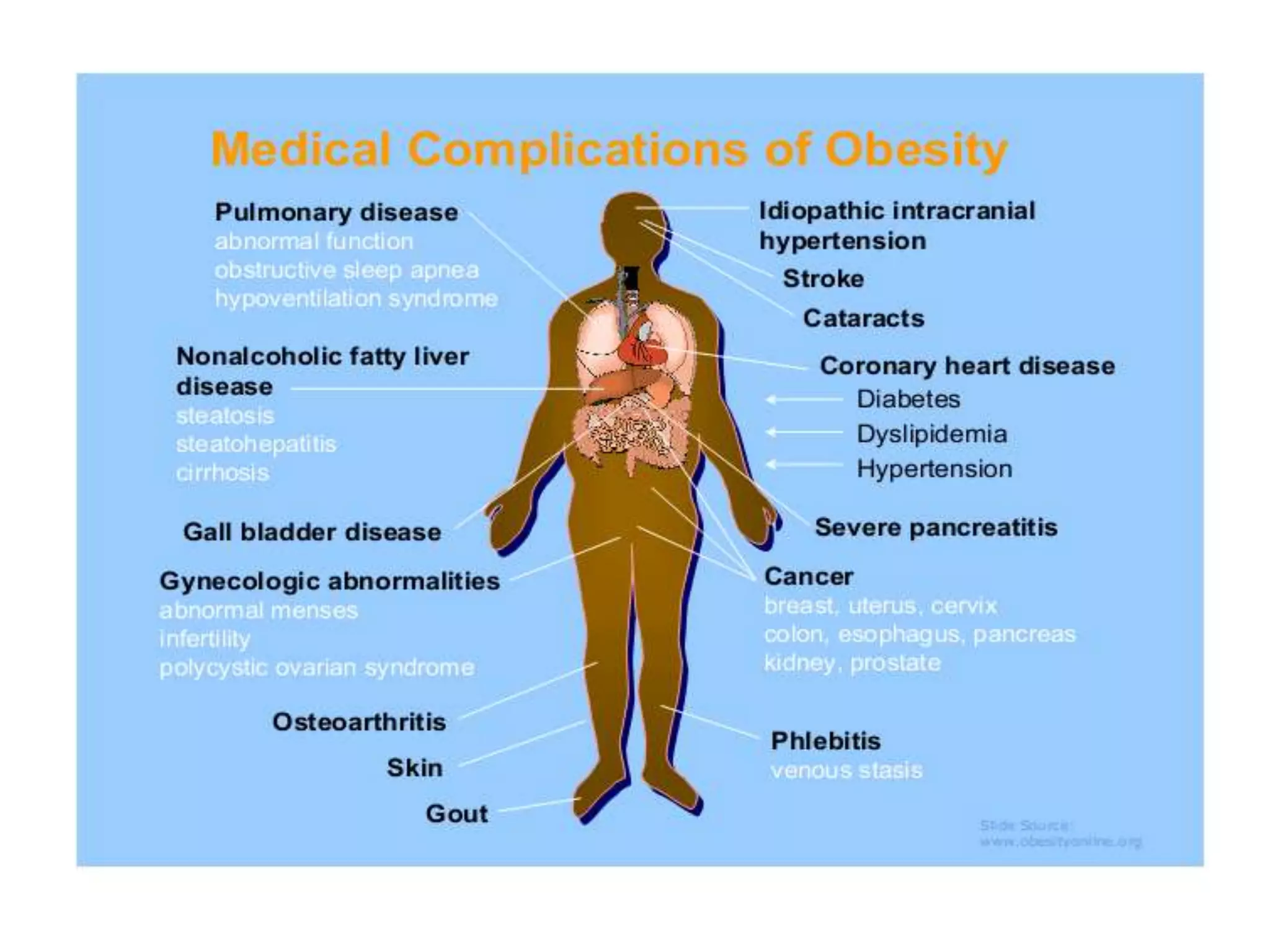 Obesity & anaesthesia | PPTX