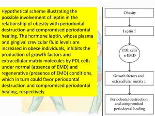 Obesity and periodontal disease | PPTX
