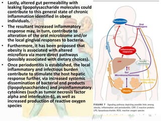Obesity and periodontal disease | PPTX