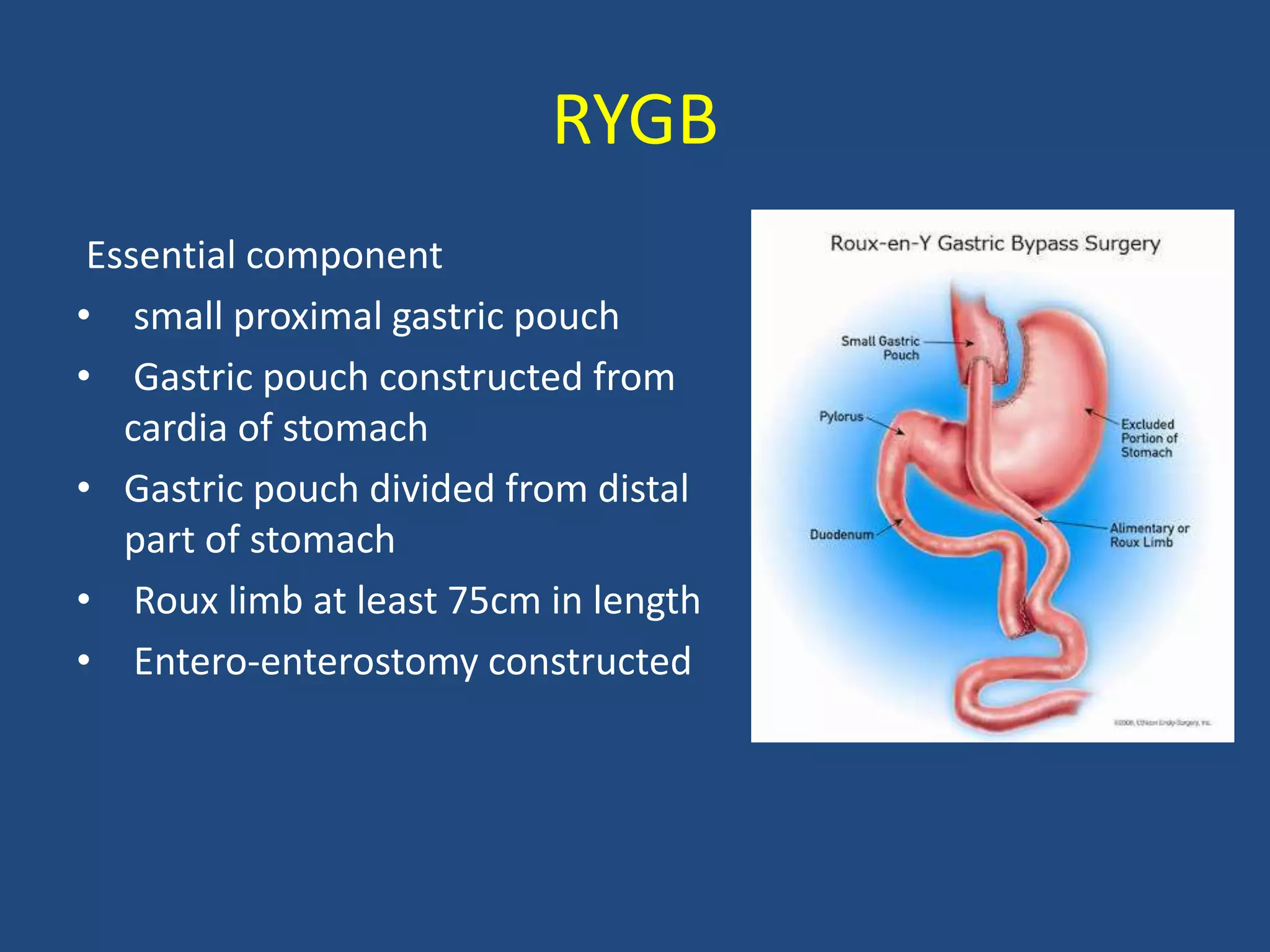 Obesity and principles of metabolic surgery | PPTX