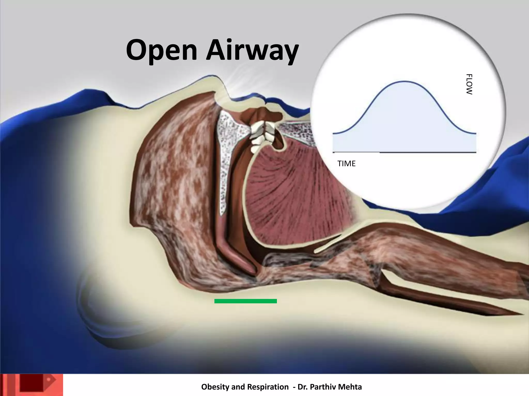 Obesity and Respiration 2016 | PPTX