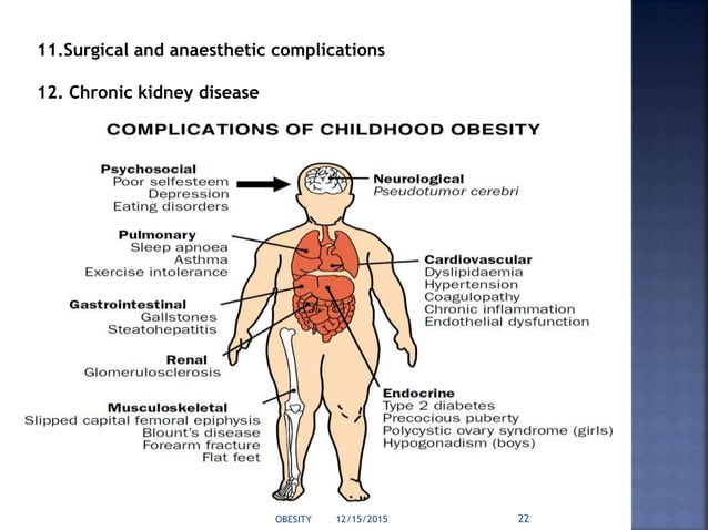 Obesity and its pathophysiology | PPTX | Diabetes | Diseases and Conditions