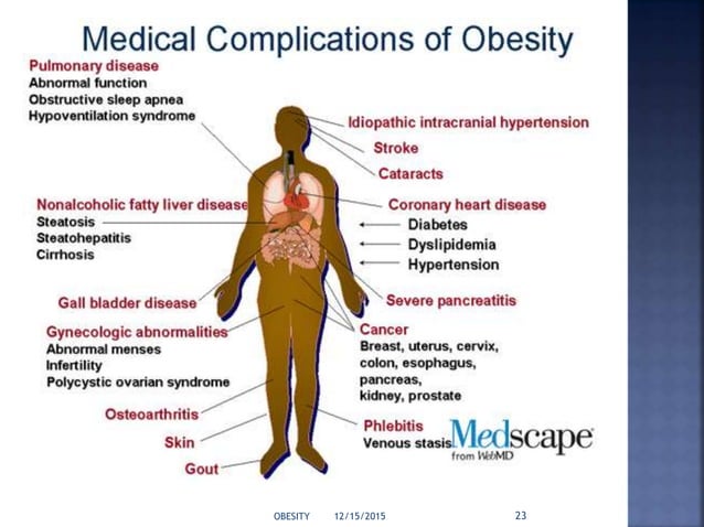 Obesity and its pathophysiology | PPTX | Diabetes | Diseases and Conditions