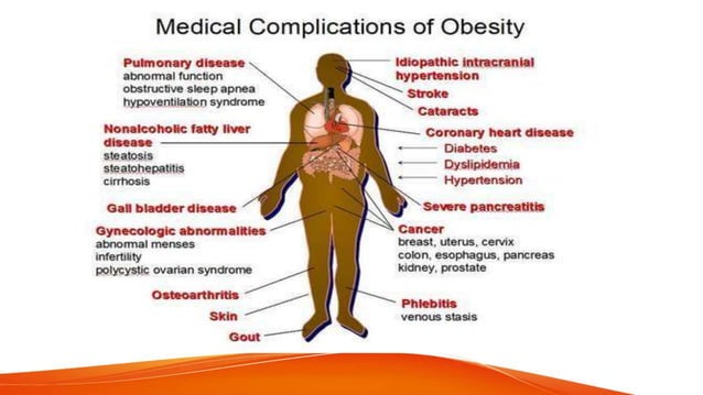 Obesity and anaesthesia | PPTX | Ear, Nose and Throat Conditions ...