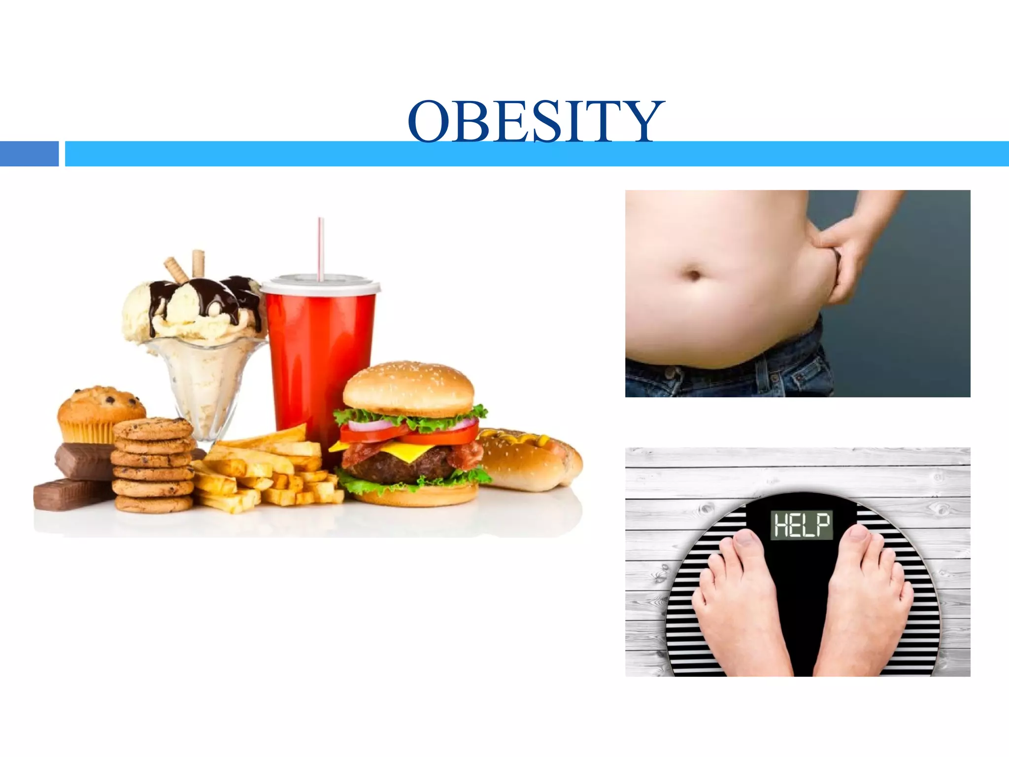 Prevention of Obesity in Adult | PPT