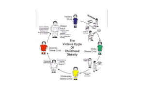 Obesity in children.pptx