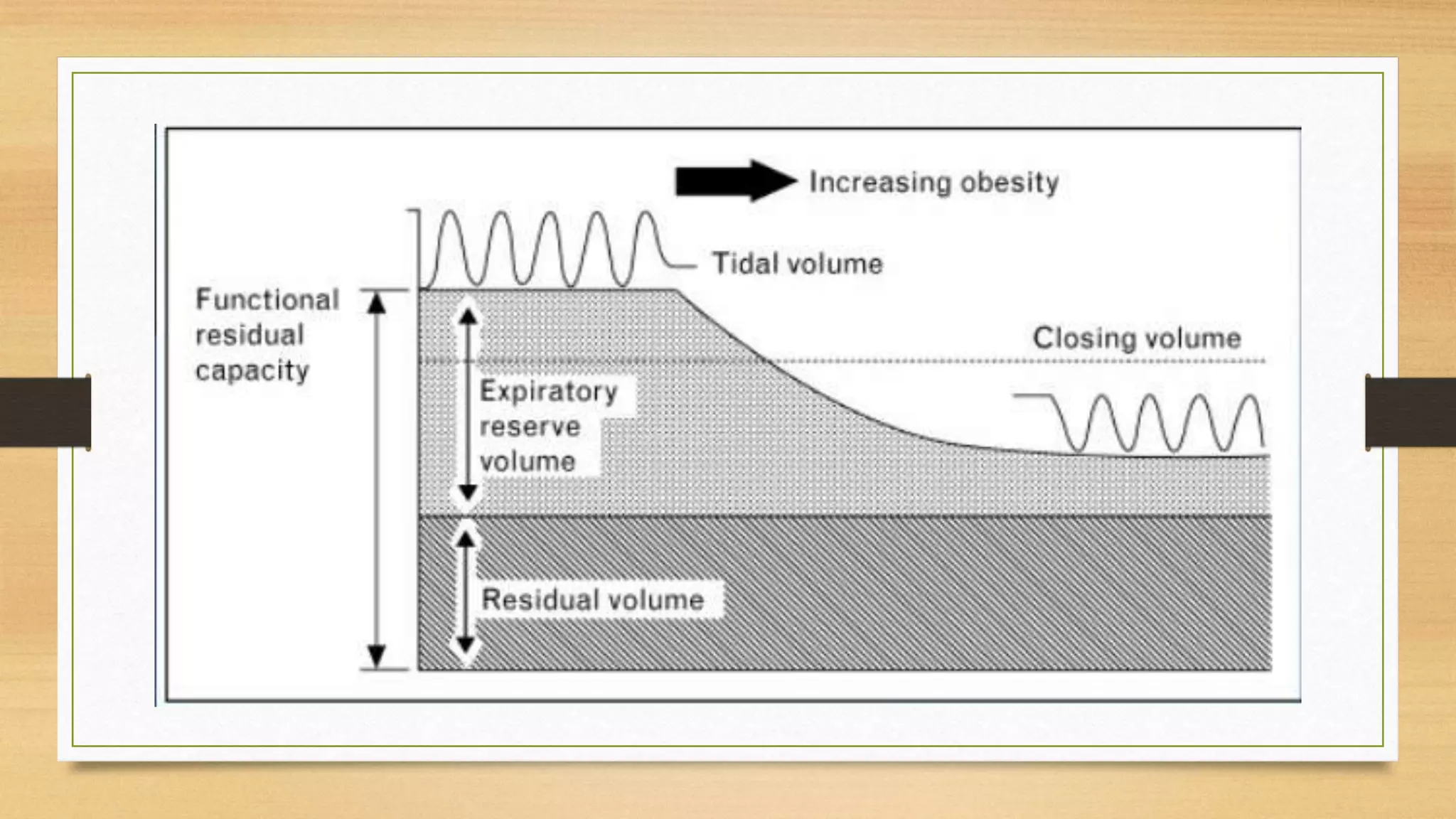 Obesity in icu | PPTX