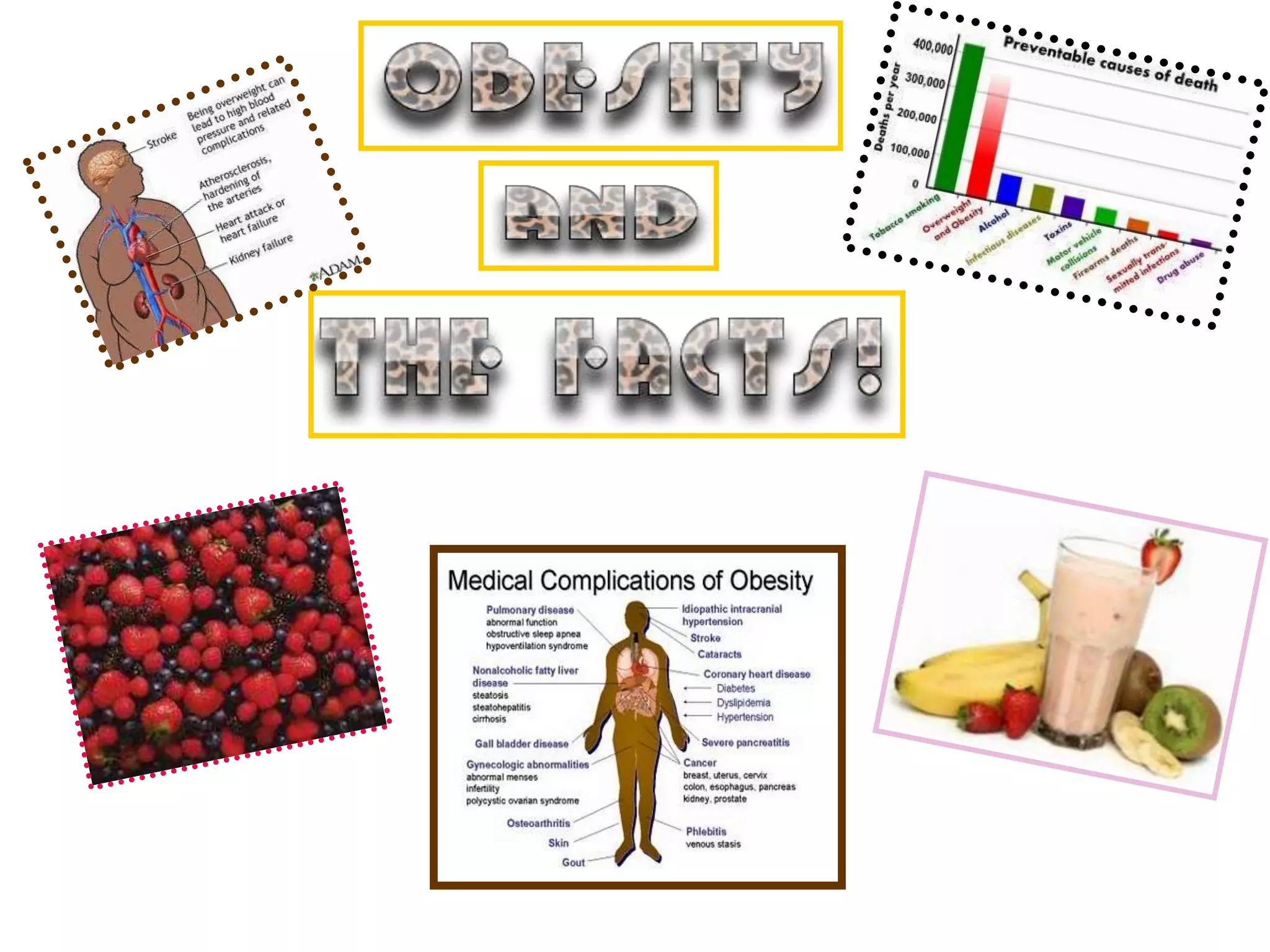 Obesity powerpoint | PPTX