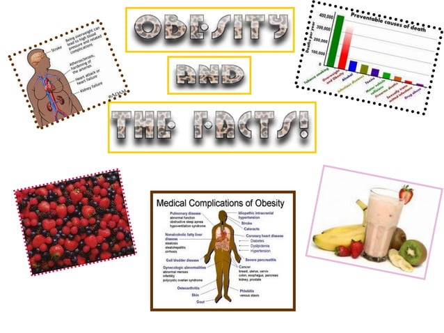 Obesity powerpoint | PPT