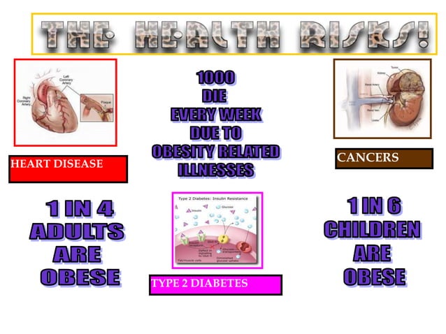 Obesity powerpoint | PPT