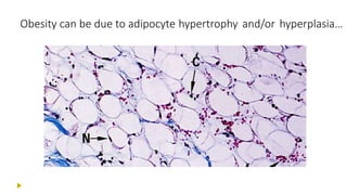 Obesity Pathology | PPTX