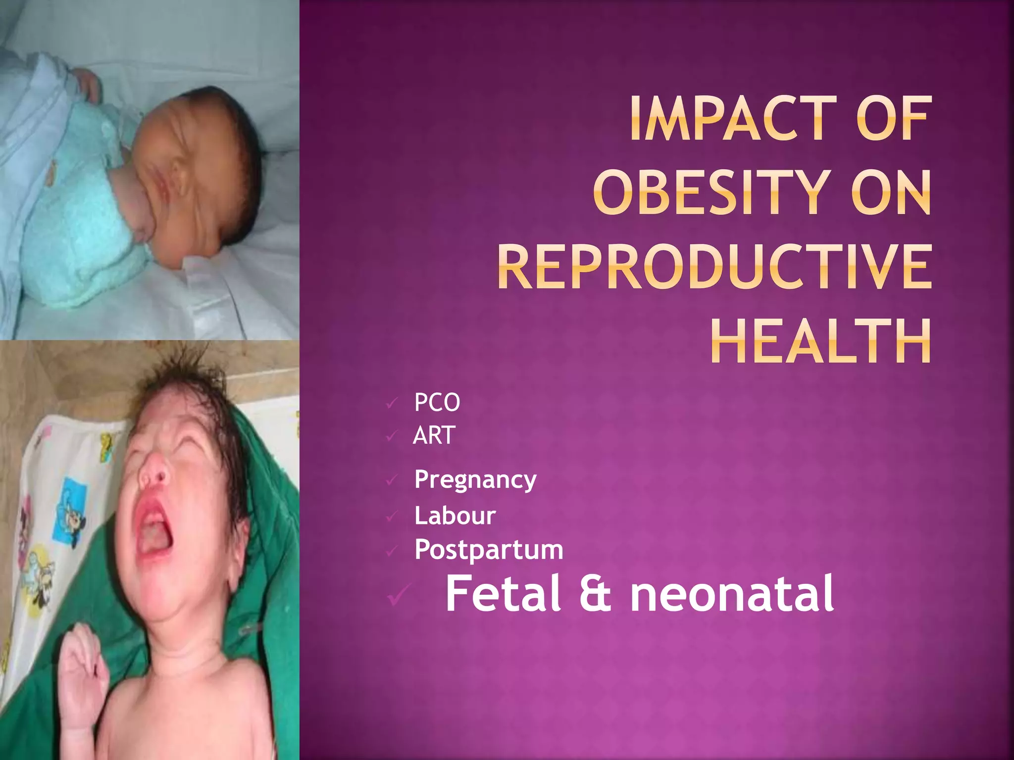 Obesity& reproductive health | PPTX