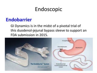 Obesity, the armamentarium | PPT