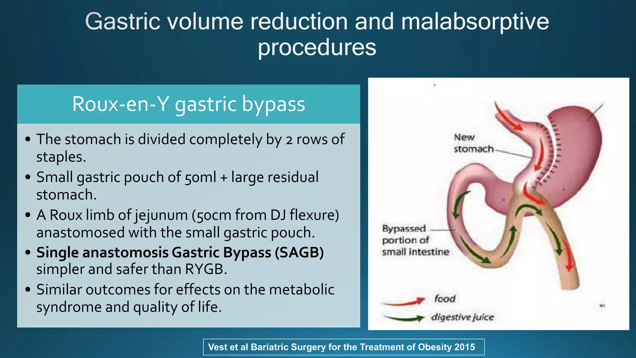 Endoscopic and surgical treatment of obesity | PPTX | Digestive ...