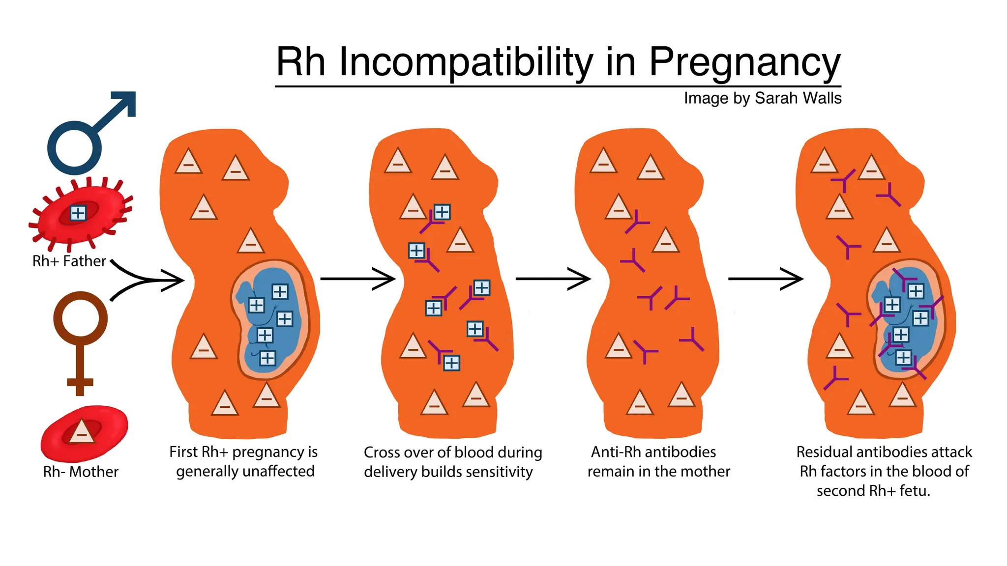 OBG- Rh isoimmunization PowerPoint presentation | PPT