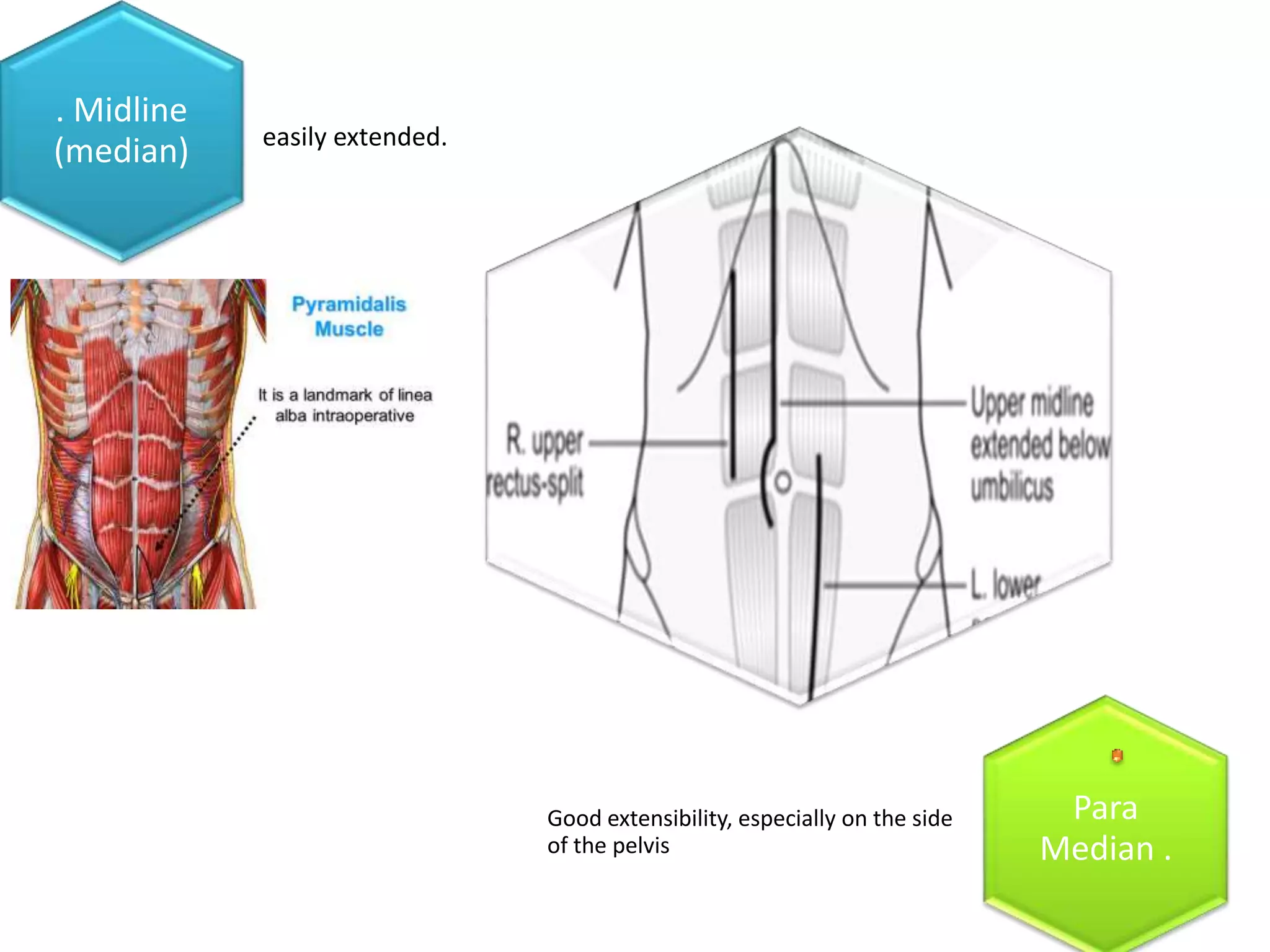 Abdominal Incisions and sutures | PPTX
