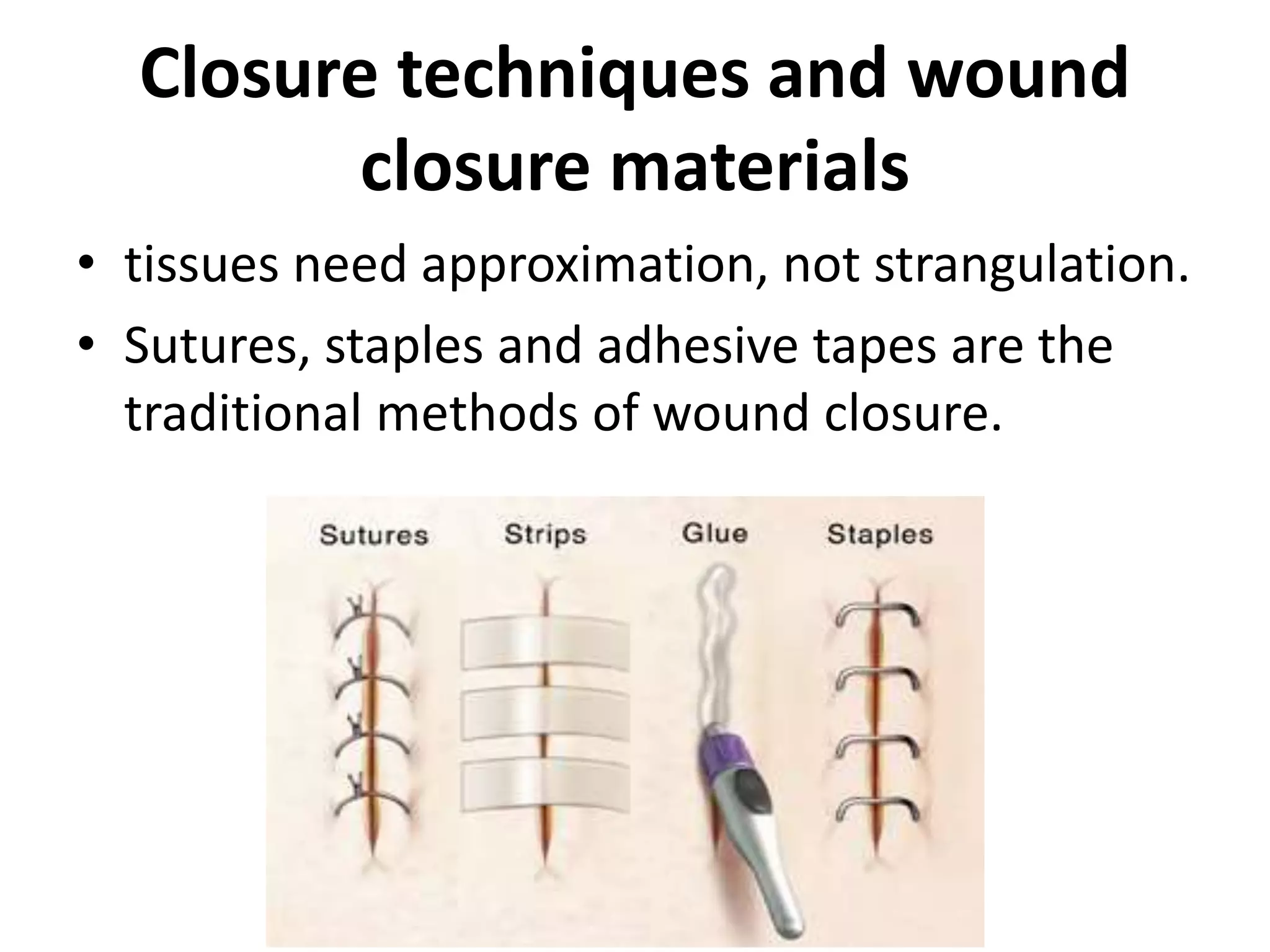 Abdominal Incisions and sutures | PPTX