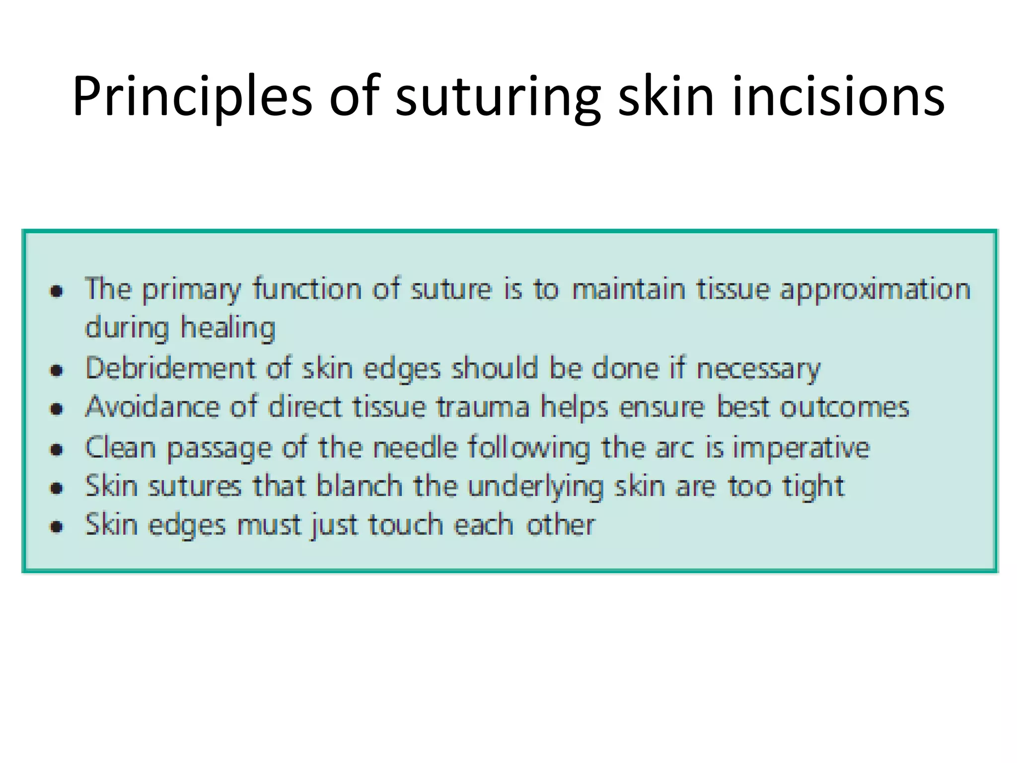 Abdominal Incisions and sutures | PPTX