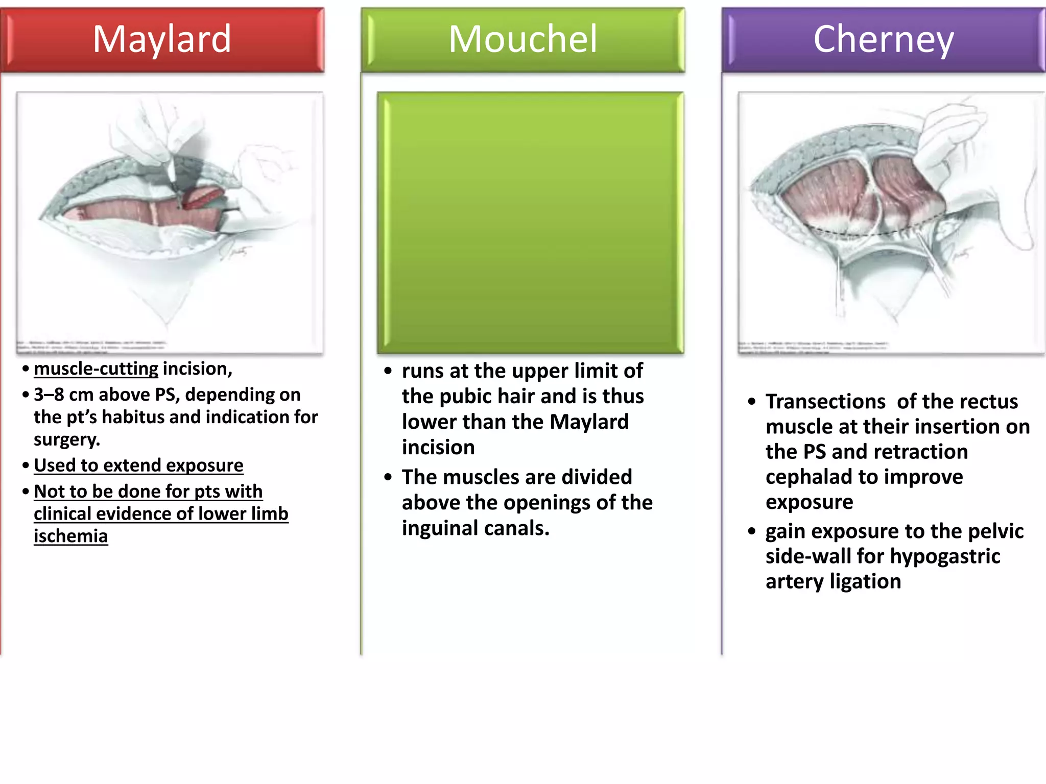 Abdominal Incisions and sutures | PPTX