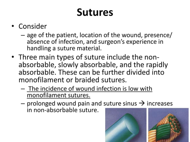 Abdominal Incisions and sutures | PPTX