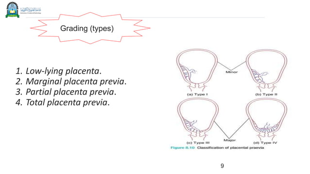 ANTIPARTUM HEMORRHAG( APH).ppt