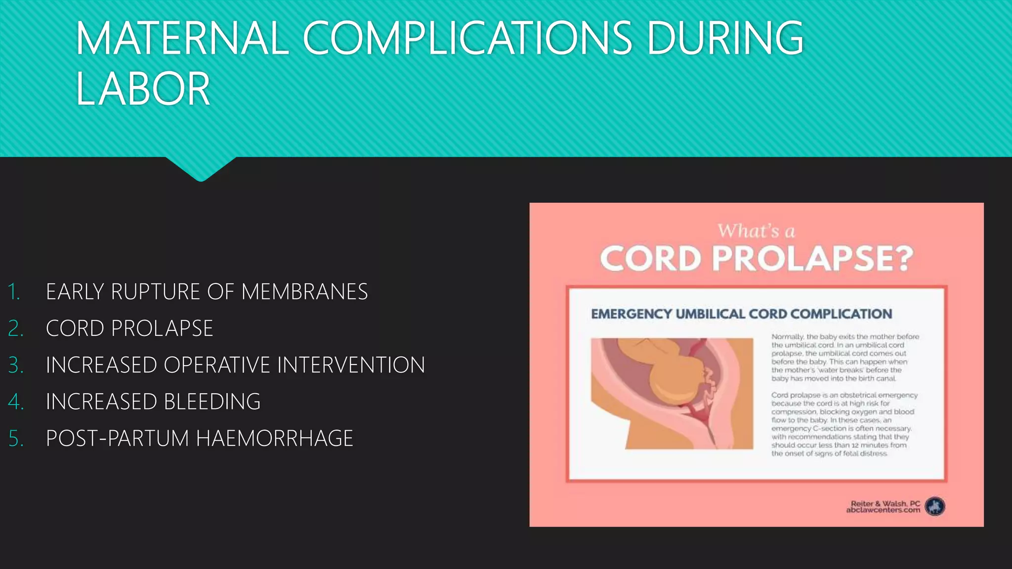 Complications of multiple pregnancy | PPTX