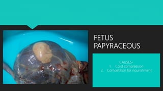 Complications of multiple pregnancy | PPTX