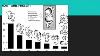 Complications of multiple pregnancy | PPTX