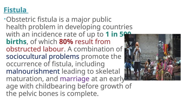Comprehensive Overview of Genito-Urinary Fistula: Etiology ...