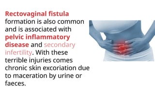 Comprehensive Overview of Genito-Urinary Fistula: Etiology ...