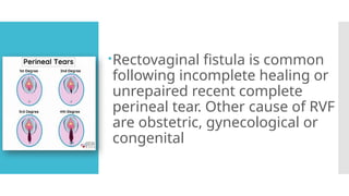 Comprehensive Overview of Genito-Urinary Fistula: Etiology ...