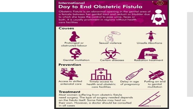 Comprehensive Overview of Genito-Urinary Fistula: Etiology ...