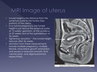 Obg gyn examination | PPT