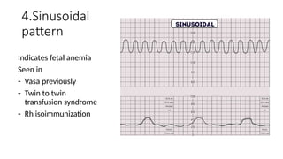 OBG seminar maternal and fetal monitoring final.pptx