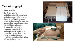 OBG seminar maternal and fetal monitoring final.pptx